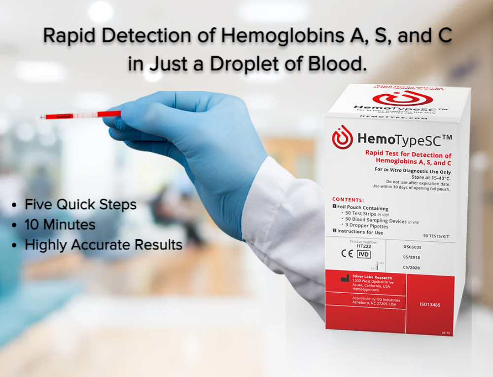 Sickle Cell Test What Is Sickle Cell Disease? Vitrosens